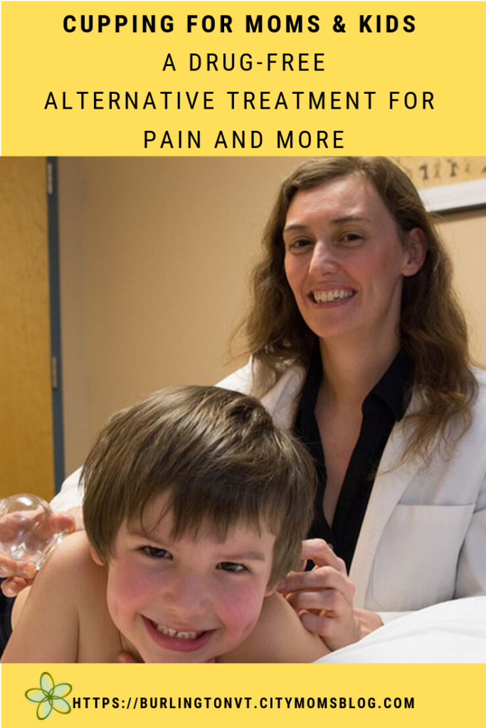 Cupping For Moms And Kids: A Natural Alternative Treatment