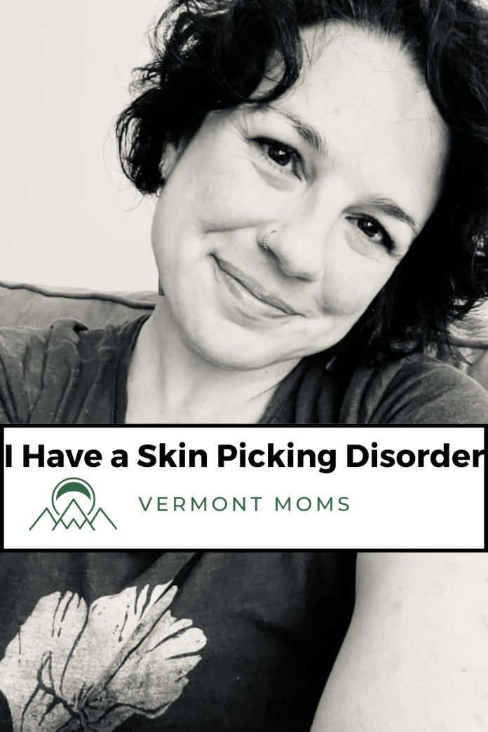 I Have A Skin Picking Disorder